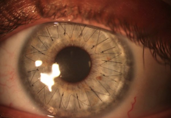 Look at These 20 Everyday Things with a Fresh New Perspective