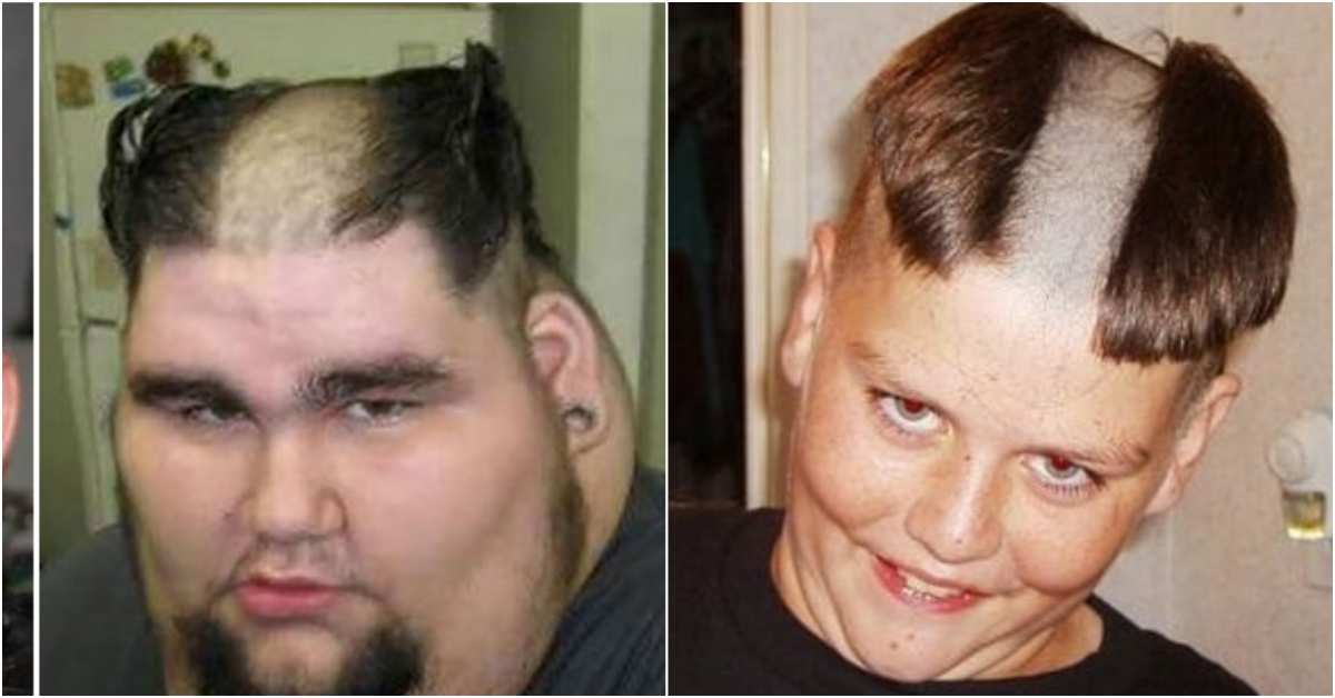 Reverse Mohawks Are a Thing...For Some Reason