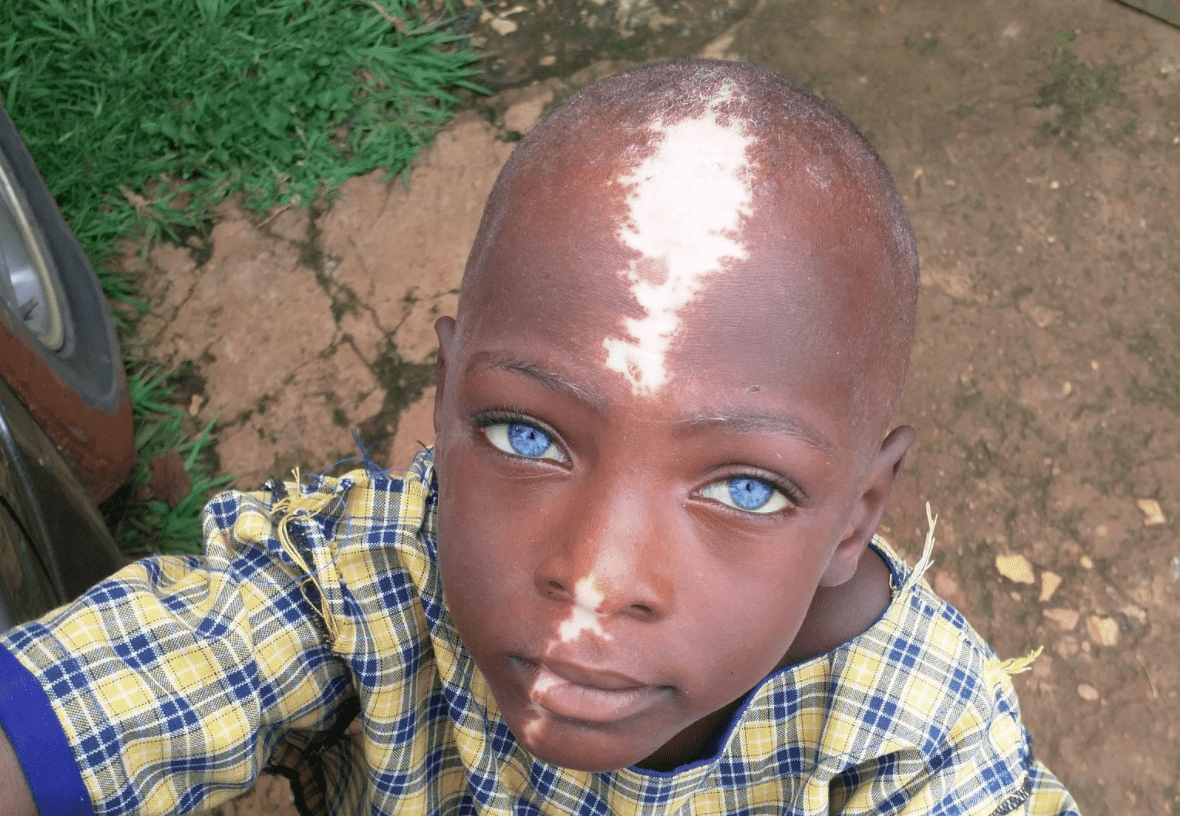 Examples of Very Unique Genetics That Will Get Your Attention